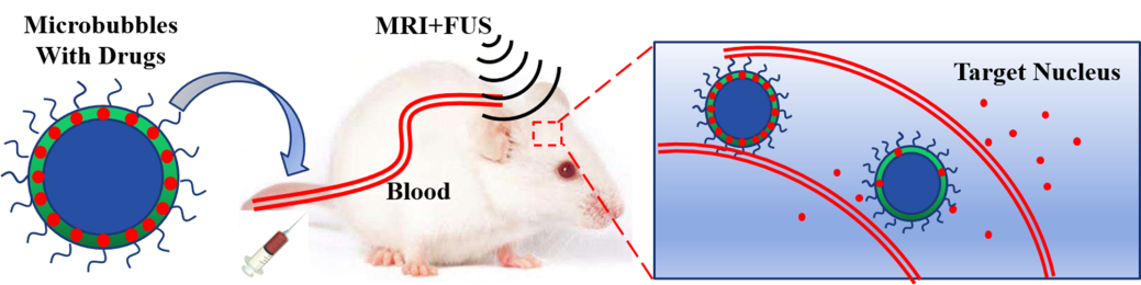 LIU Hanqing, M.D., PhD.-研究动态-深圳市萨米国际医疗中心（深圳市第四人民医院）-市属公立医院